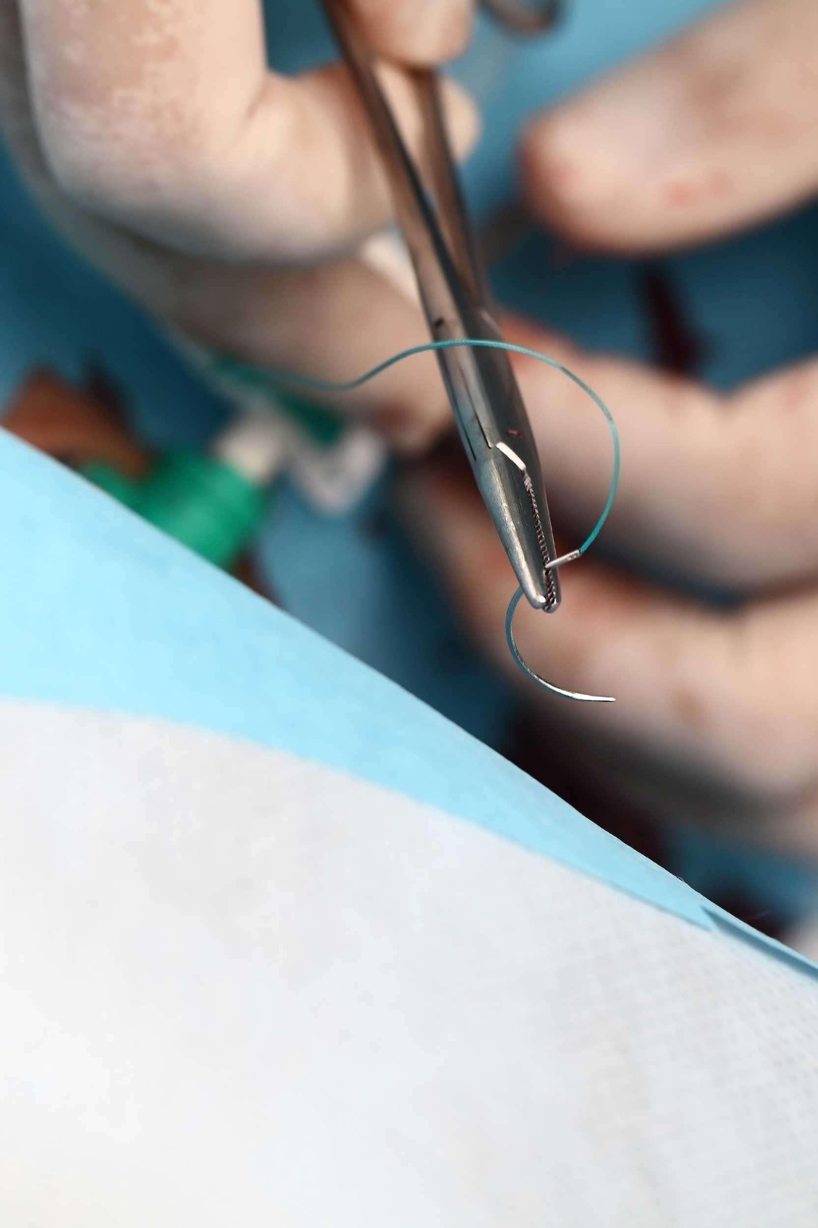 Surgical – Alluma Dermatology